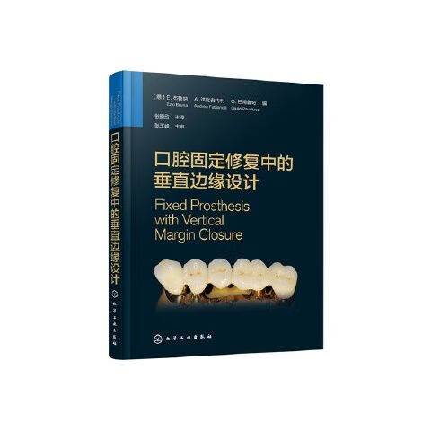口腔固定修复中的垂直边缘