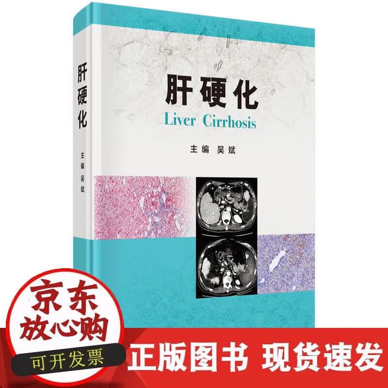 【现货】肝硬化