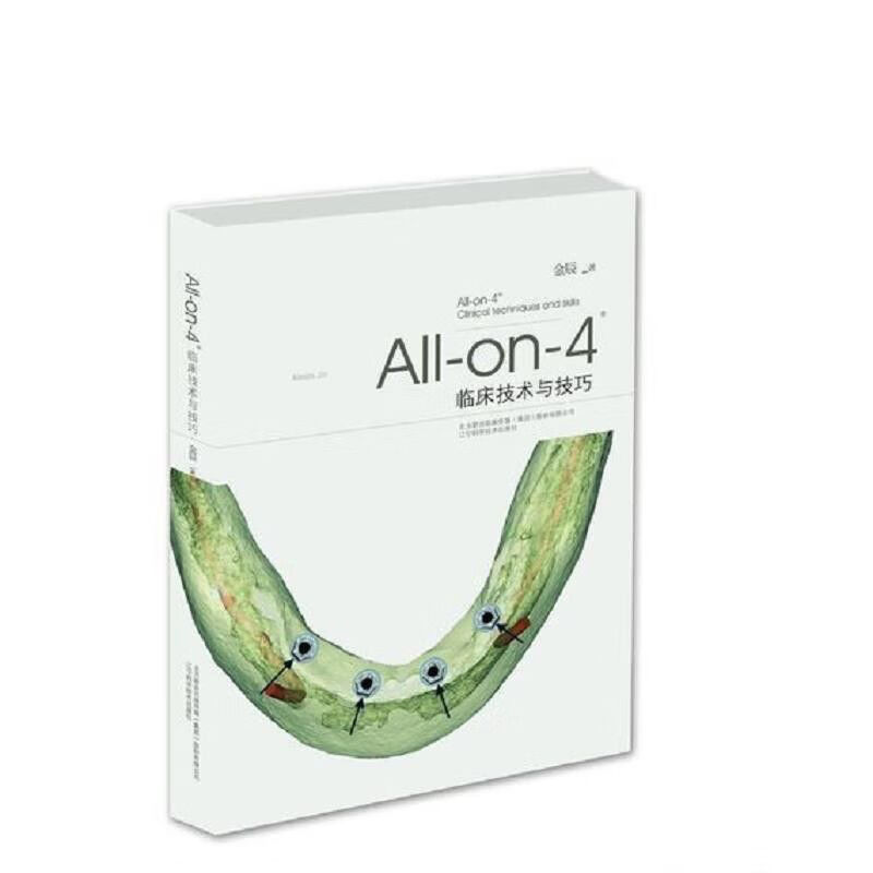 All-on-4 临床与技巧。 彩色