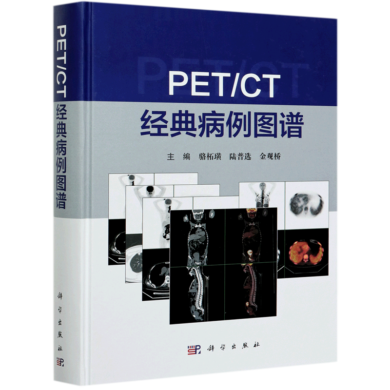 PET\CT经典病例图谱(精)