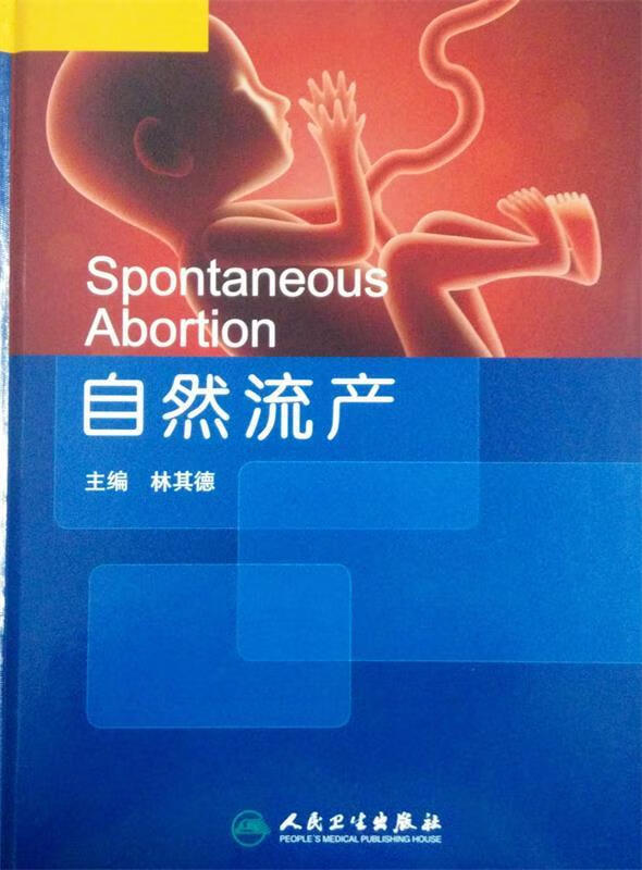 自然流产（精）