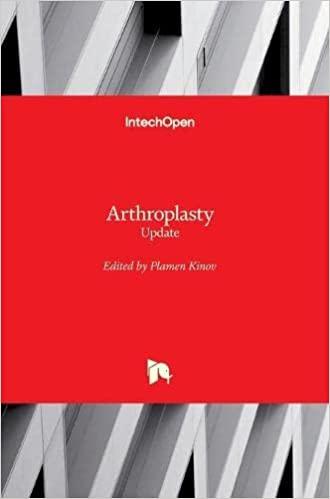 Arthroplasty - Update