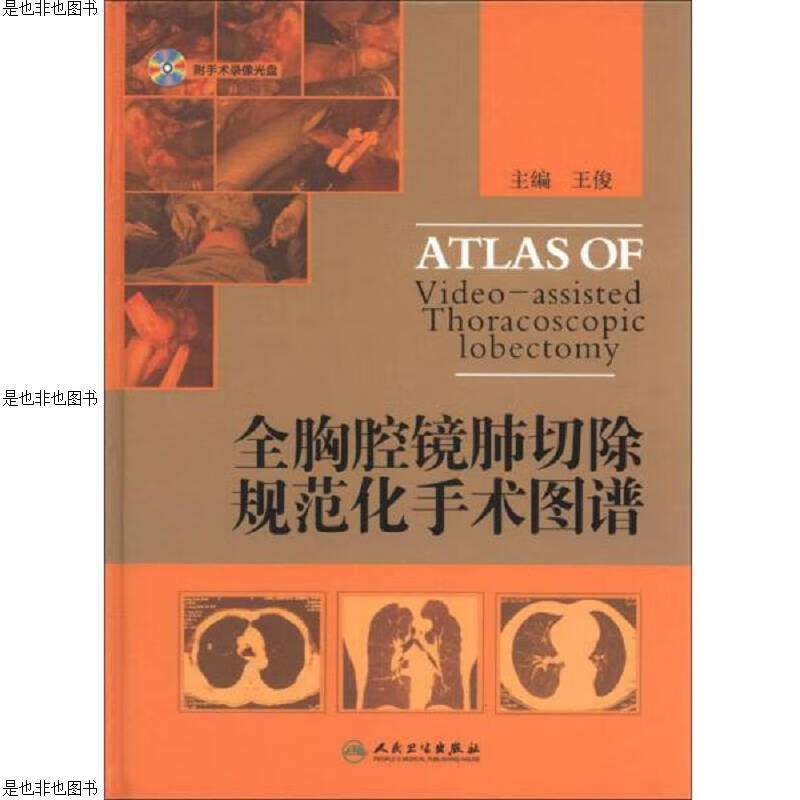 全胸腔镜肺切除规范化手术图谱(没有书皮)