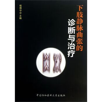 下肢静脉曲张的诊断与治疗