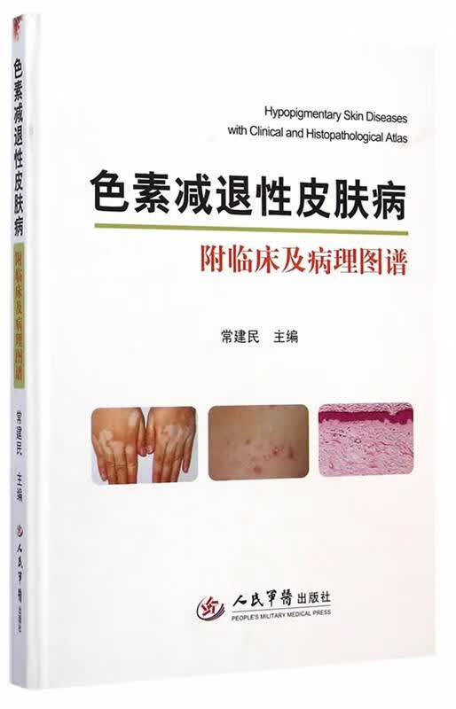 色素减退性皮肤病-附临床及病理图谱