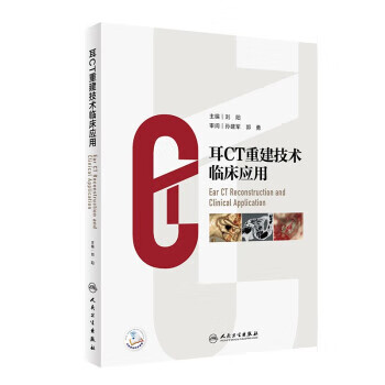 耳CT重建技术临床应用(精)