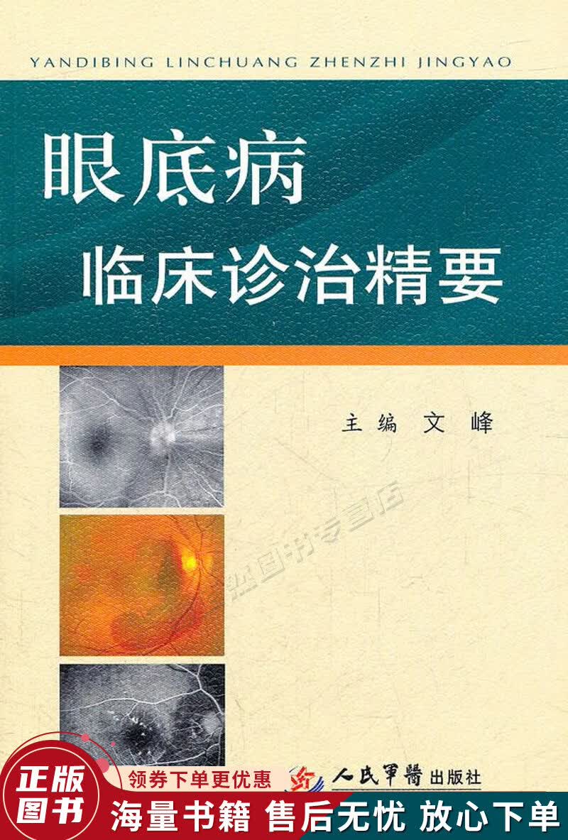 眼底病临床诊治精要