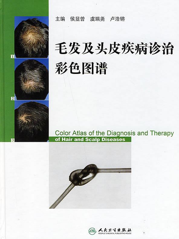毛发及头皮疾病诊治彩色图谱