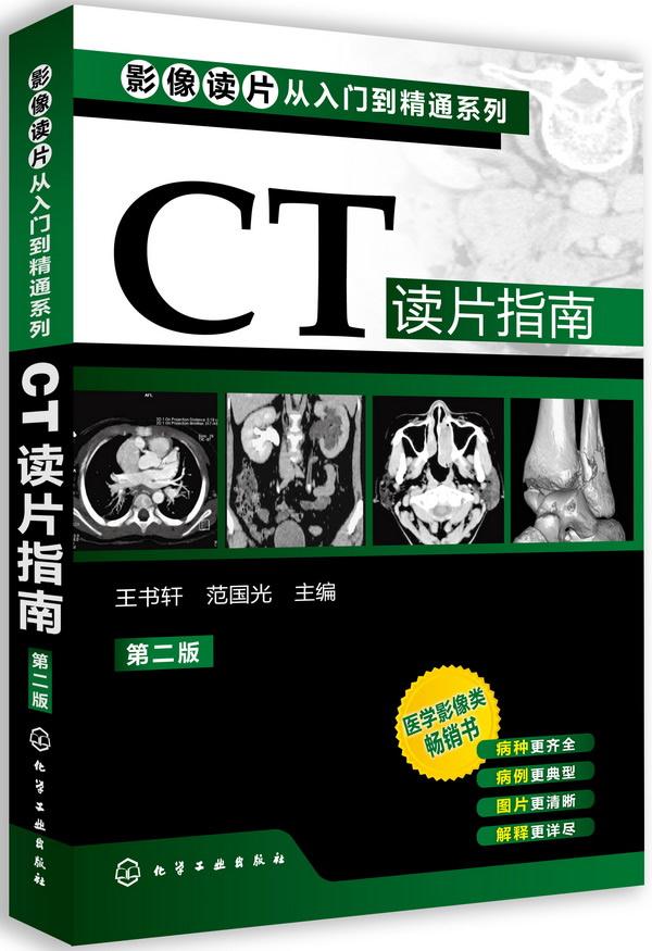 影像读片从入门到精通系列：CT读片指南（第2版） 王书轩,王书轩主编 化学工业出版社