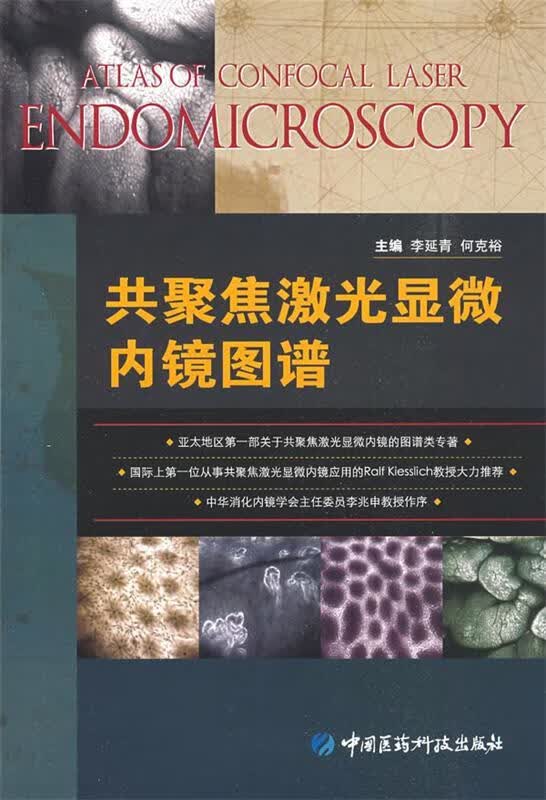 共聚焦激光显微内镜图谱