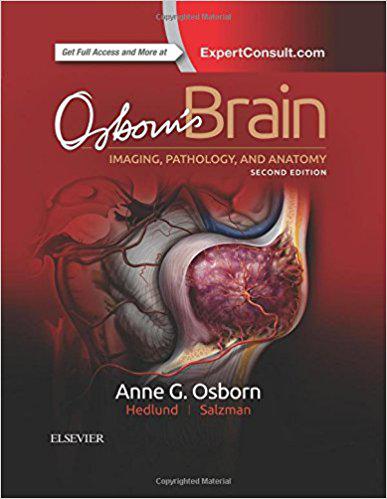 Osborn's Brain Osborn 大脑