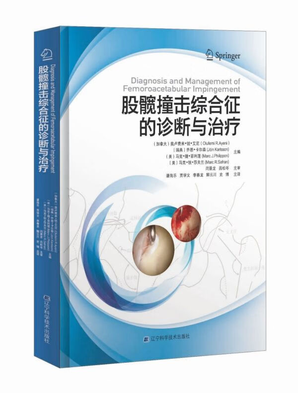股髋撞击综合征的诊断与治疗(精)