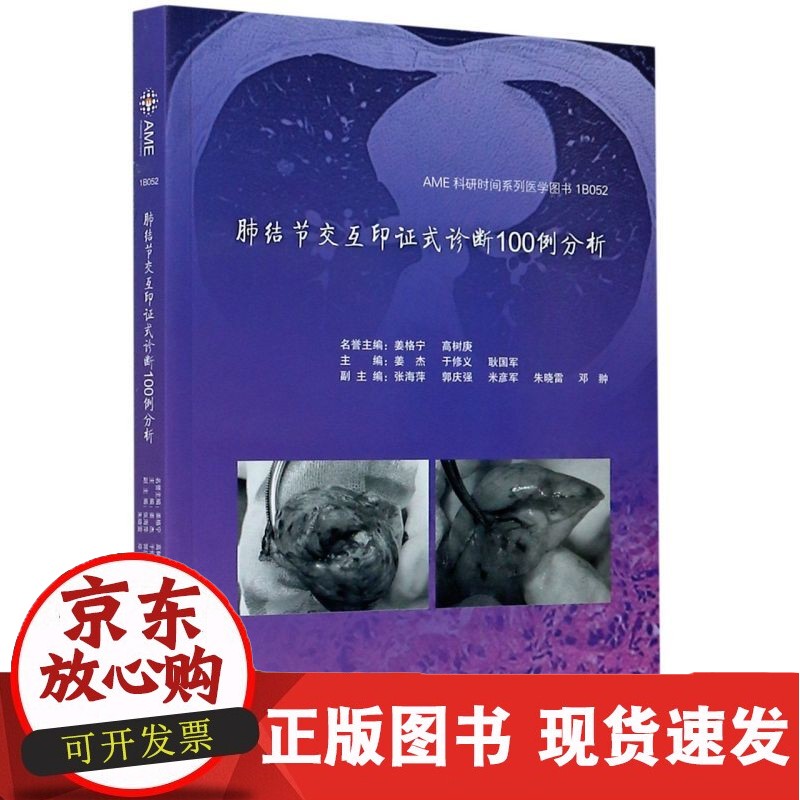 肺结节交互印证式诊断100例分析