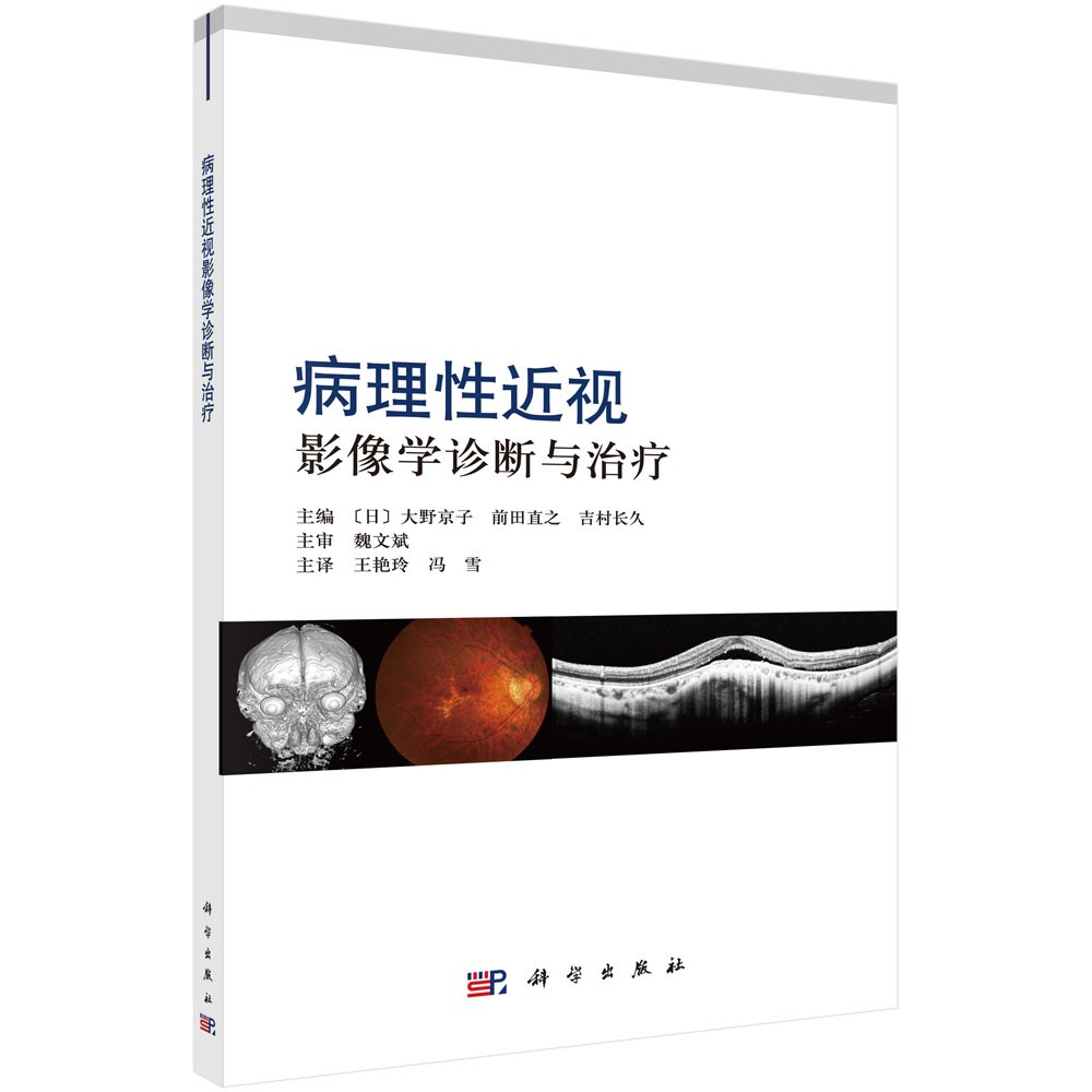 病理性近视影像学诊断与治疗《现货速发》