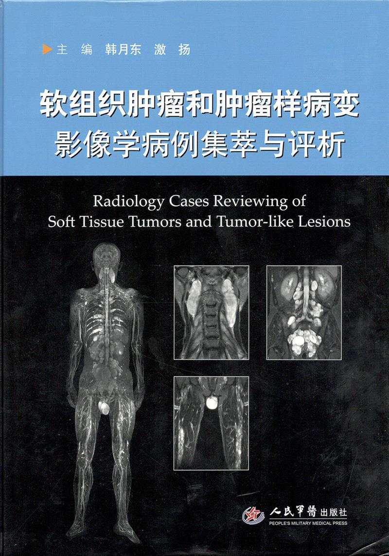 软组织肿瘤和肿瘤样病变影像学病例集萃与评析