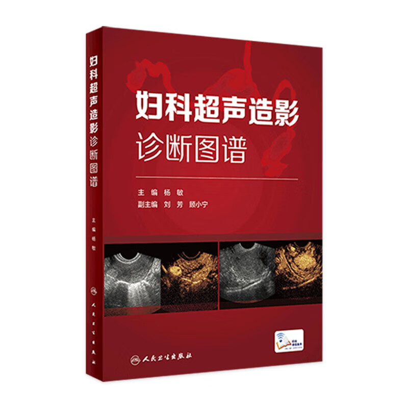 妇科超声造影诊断图谱