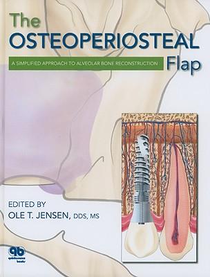 高被引The Osteoperiosteal Flap: A Simplified Appro