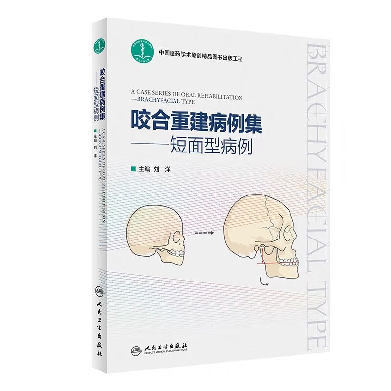 咬合重建病例集·短面型病例