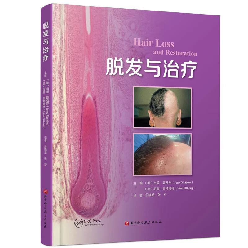 脱发与治疗 北京科学技术出版社 段晓涵 张舒译 模式型脱发 发病机制 临床表现 诊断和治疗 应对脱发的非医疗手段 毛发移植 书籍