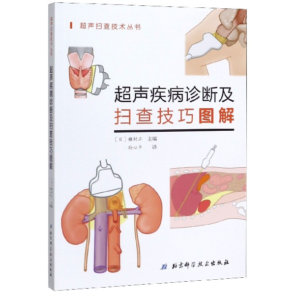 超声疾病诊断及扫查技巧图解/超声扫查技术丛书