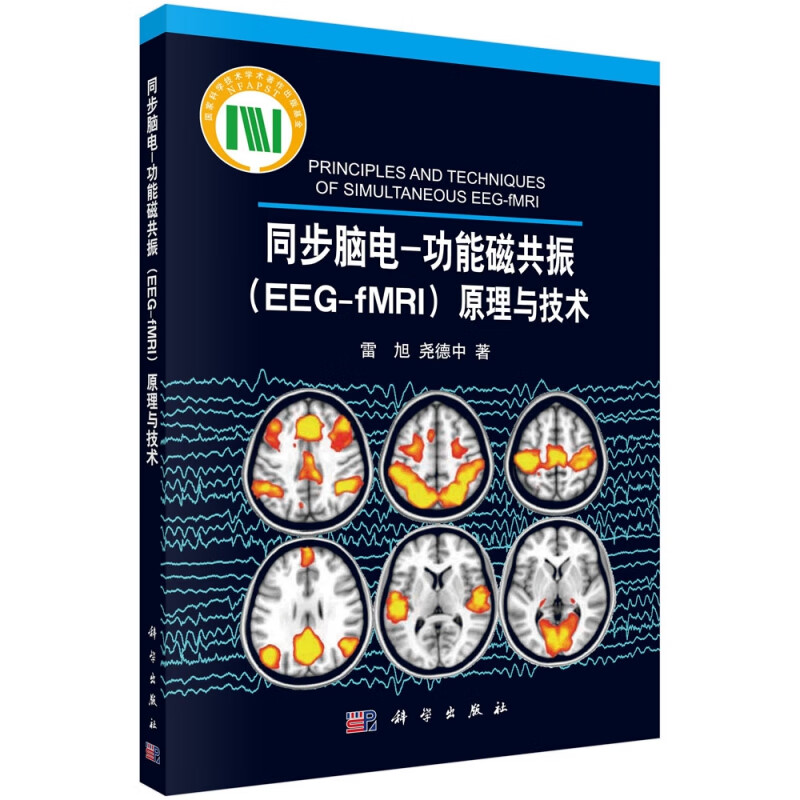 同步脑电-功能磁共振<EEG-fMRI>原理与技术