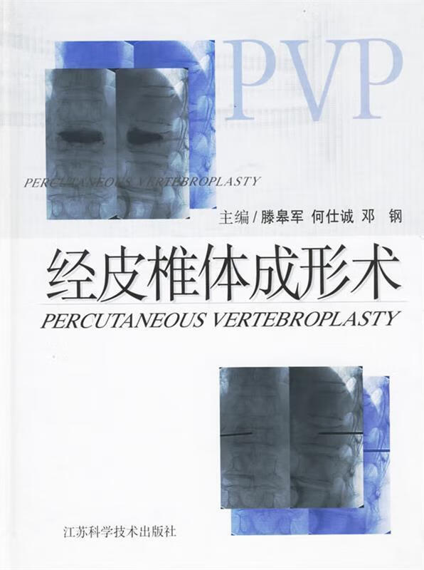 经皮椎体成形术 滕皋军等 江苏科学技术出版社 9787534545146