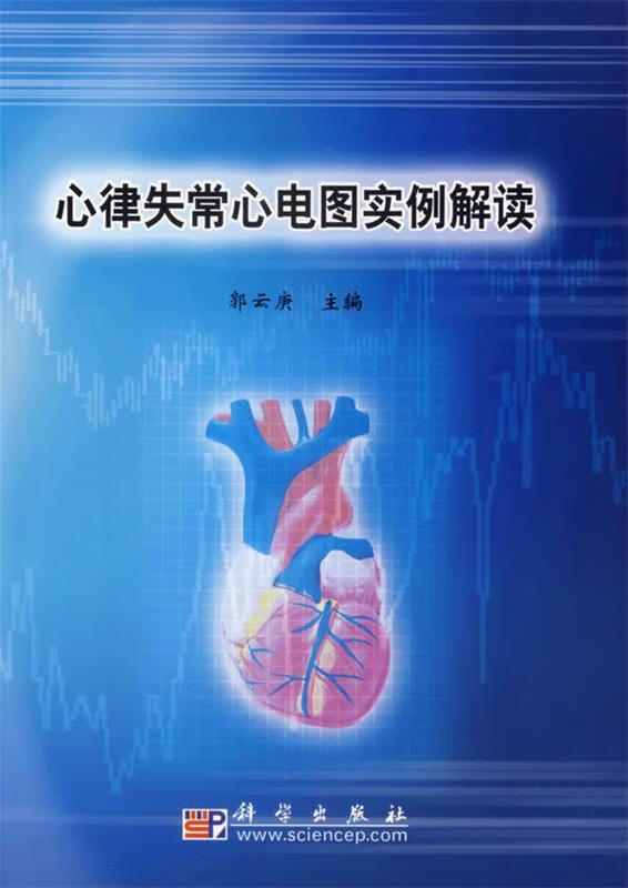 心律失常心电图实例解读