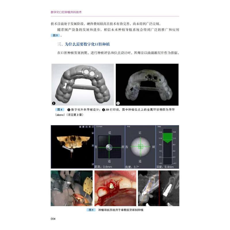 数字化口腔种植外科技术
