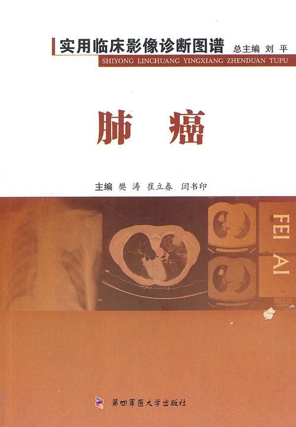 实用临床影像诊断图谱：肺癌
