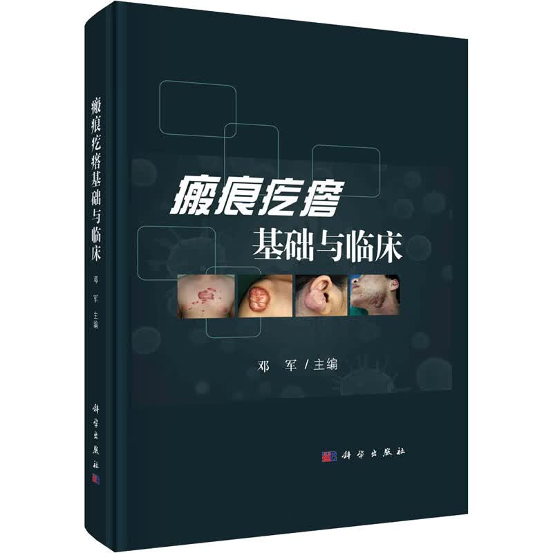 瘢痕疙瘩基础与临床 图书