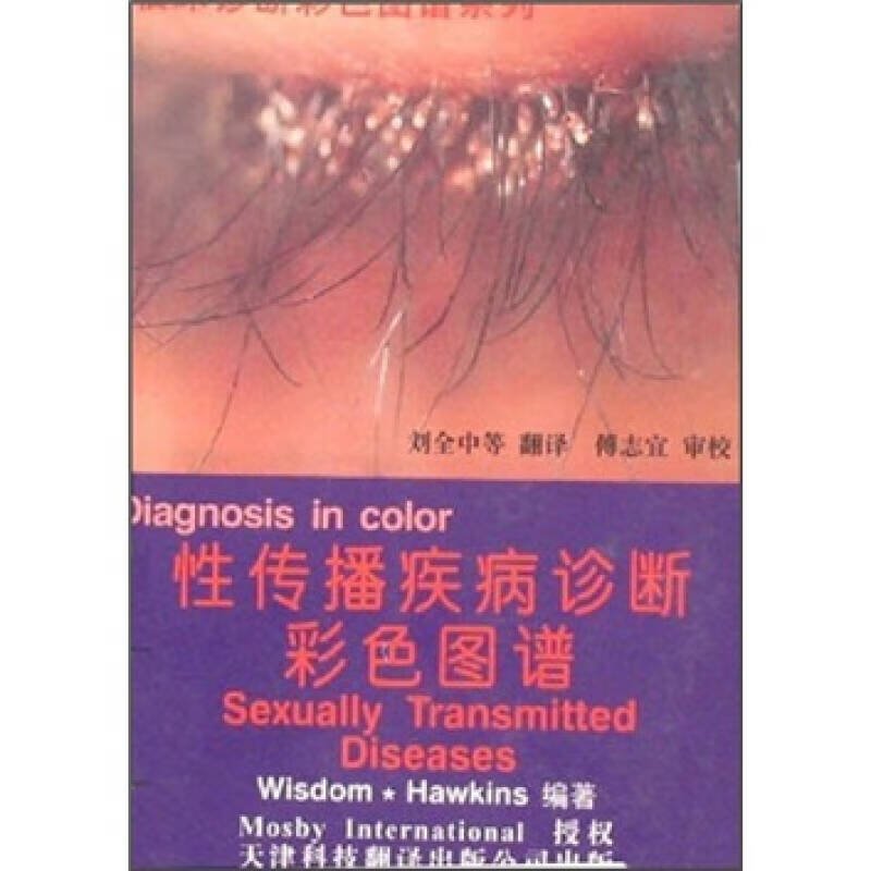 性传播疾病诊断彩色图谱【好书】