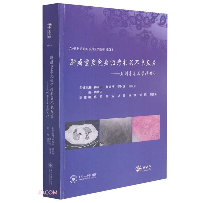 肿瘤重度免疫治疗相关不良反应--病例集萃及管理共识(精)/AME科研时间系列医学图书