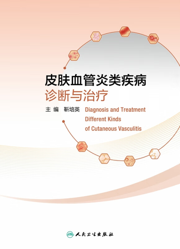 皮肤血管炎类疾病诊断与治疗