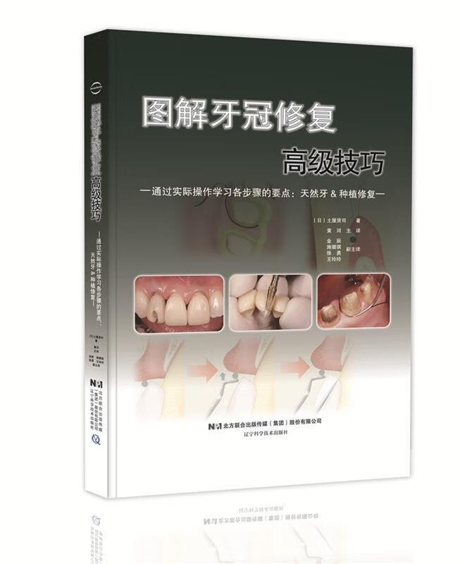 图解牙冠修复高级技巧【好书，下单速发】