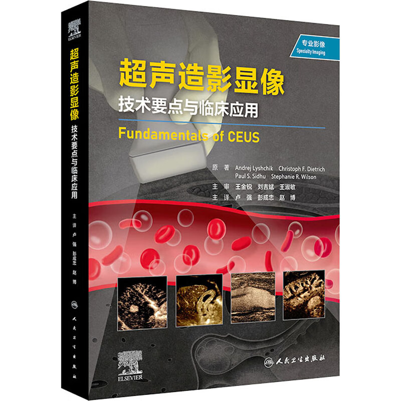 超声造影显像 技术要点与临床应用 图书