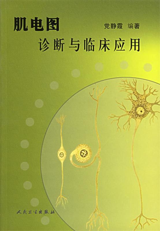 肌电图诊断与临床应用