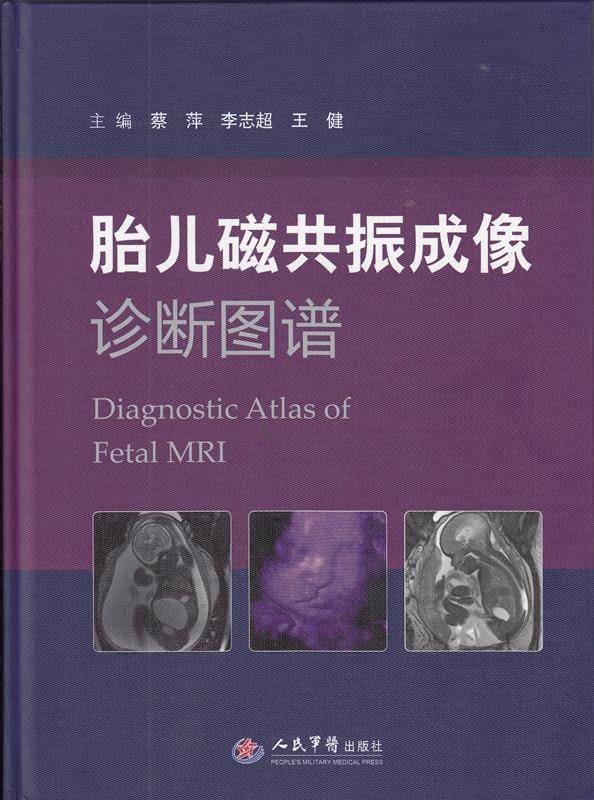 胎儿磁共振成像诊断图谱