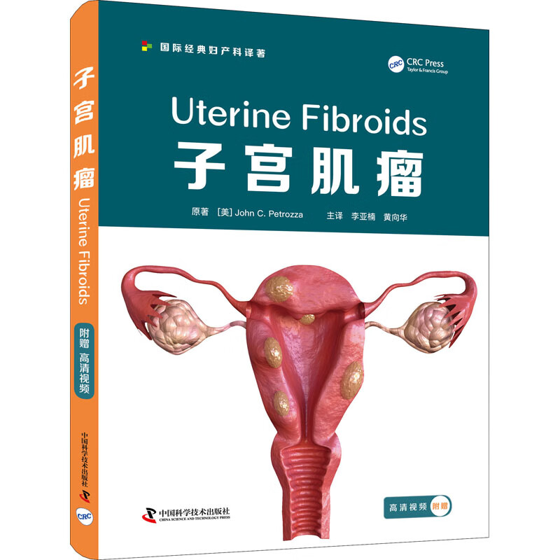 子宫肌瘤