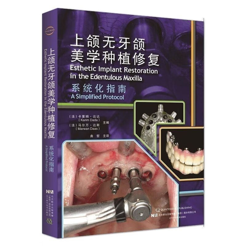 上颌无牙颌种植修复系统化指南 口腔疾病诊断治疗卡里姆达达