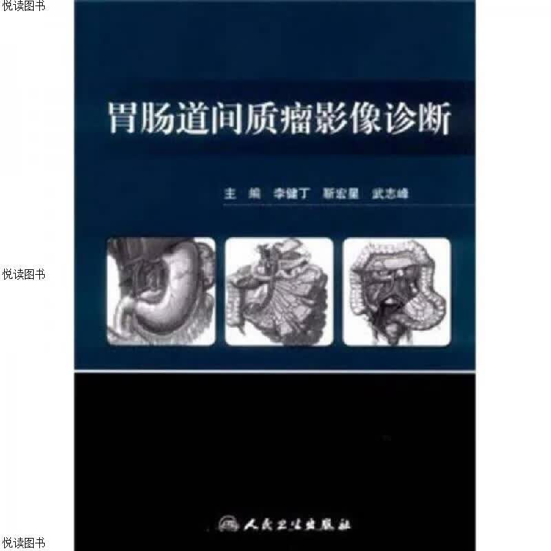 胃肠道间质瘤影像诊断