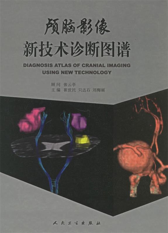 颅脑影像新技术诊断图谱