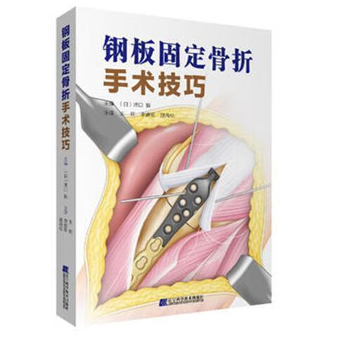 【自营配送】钢板固定骨折手术技巧