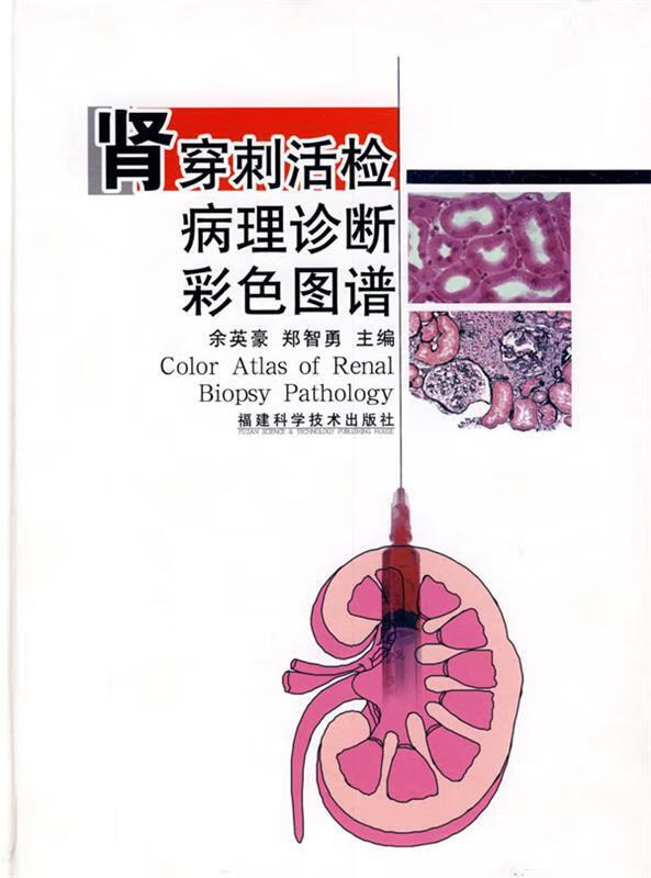 【现货】肾穿刺活检病理诊断彩色图谱
