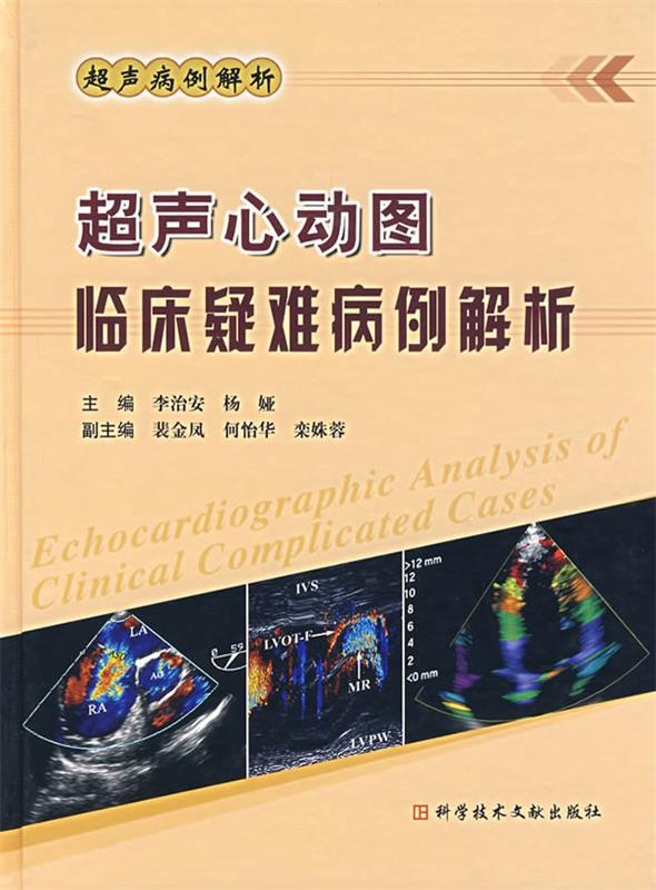 超声心动图临床疑难病例解析