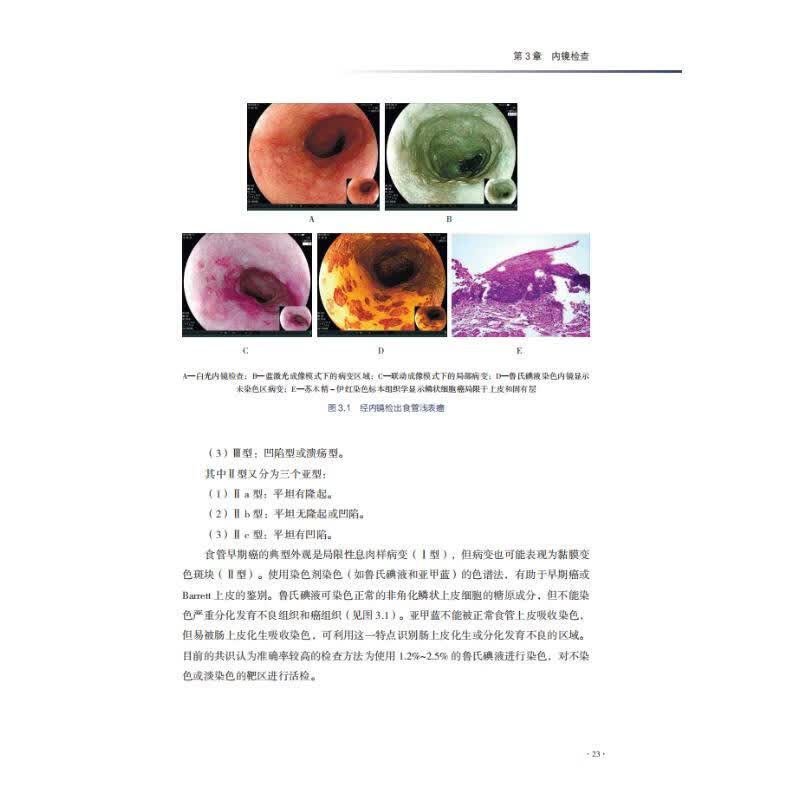 实用食管癌手术学 图书