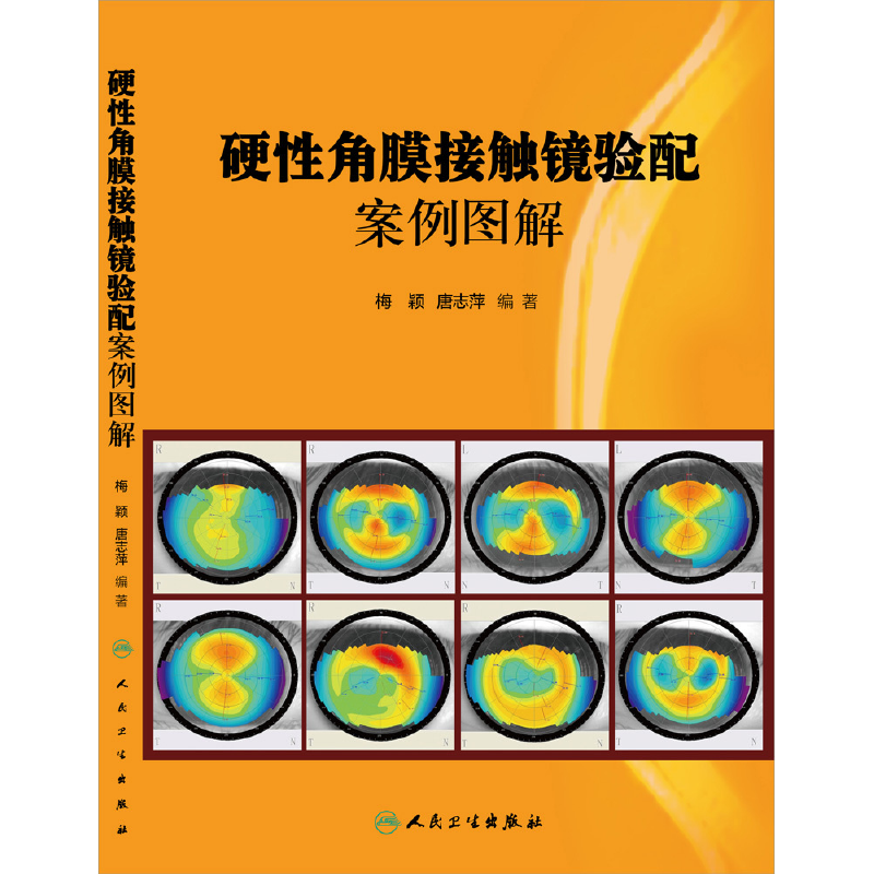 硬性角膜接触镜验配案例图解 梅颖、唐志萍 口腔科学生活 人民卫生出版社