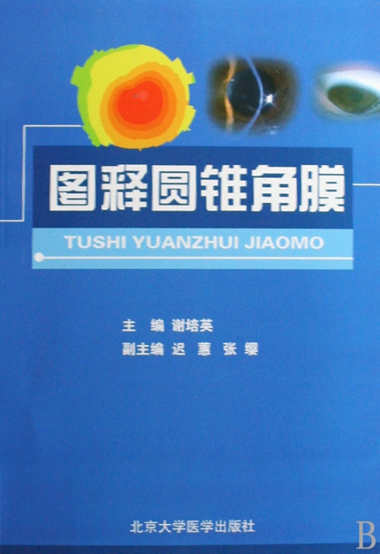 图释圆锥角膜