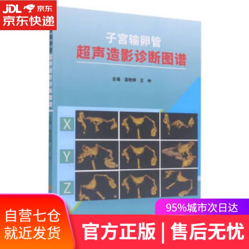 子宫输卵管超声造影诊断图谱 温艳婷,王仲 编 四川科学技术出版社