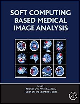 Soft Computing Based Medical Image Analysis