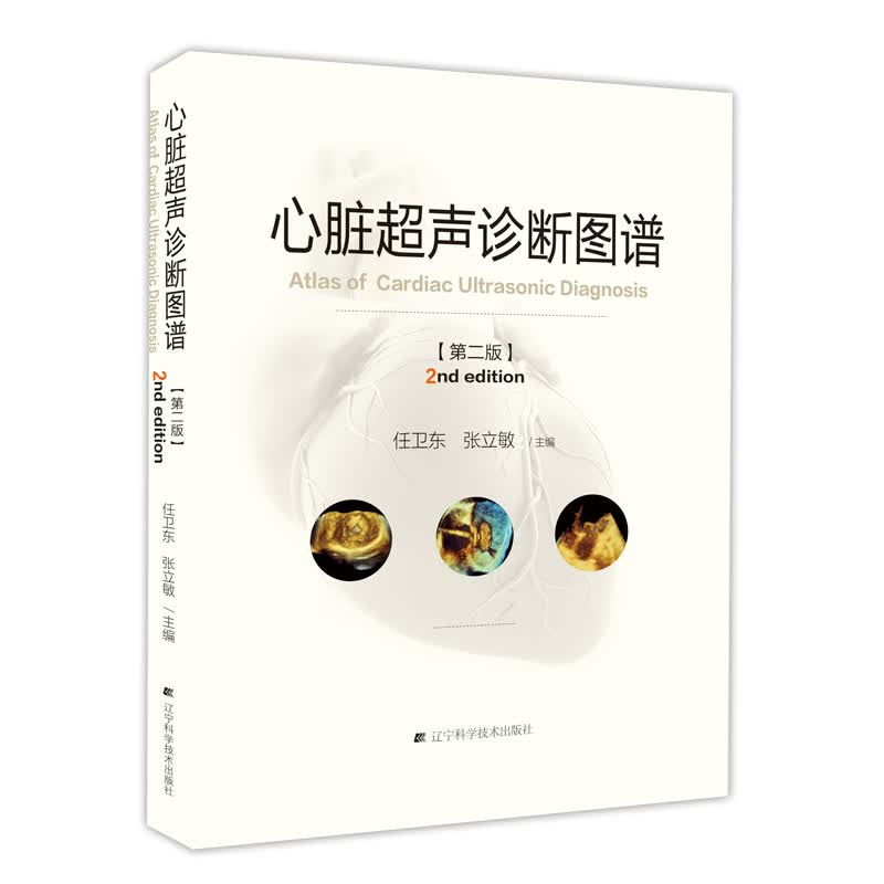 心脏超声诊断图谱（第二版）